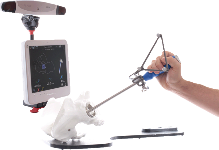 BLU-IGS – Orthokey | Innovation in surgery